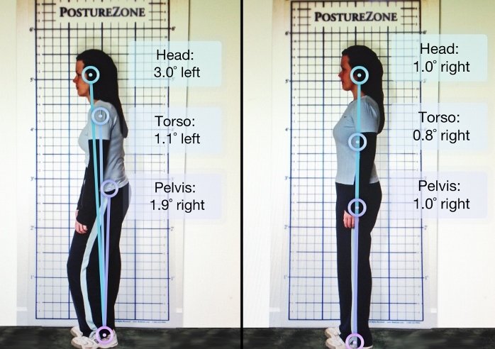Posture Pictures assessment as a first step to help clients improve ...